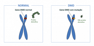 O que é Distrofia Muscular de Duchenne (DMD)? - Movimento Duchenne